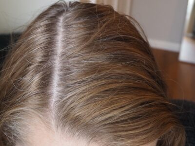 Graue Haare - Update - Irit Eser